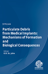 Failure Mechanism of a Metal-Backed Patella: An Implant Retrieval Study ...
